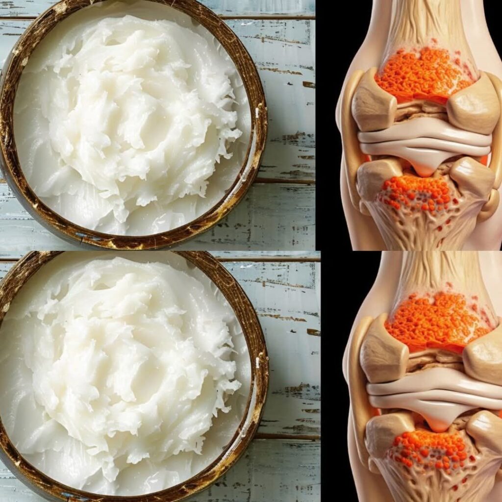 Foods to Rebuild Knee Cartilage: This Is What You Should Eat! – iadun