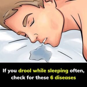 6 Health Issues Behind Excessive Drooling at Night – iadun