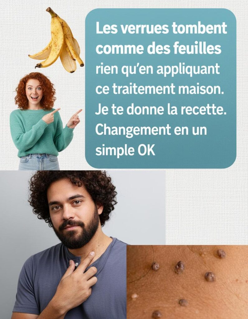 Les verrues tombent comme des feuilles avec ce simple traitement maison ...
